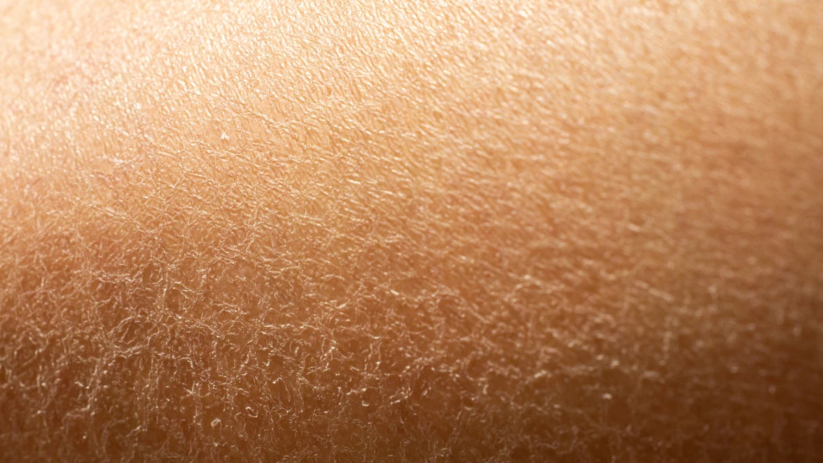 Peau sèche : identifier les causes pour la protéger – NOOANCE PARIS