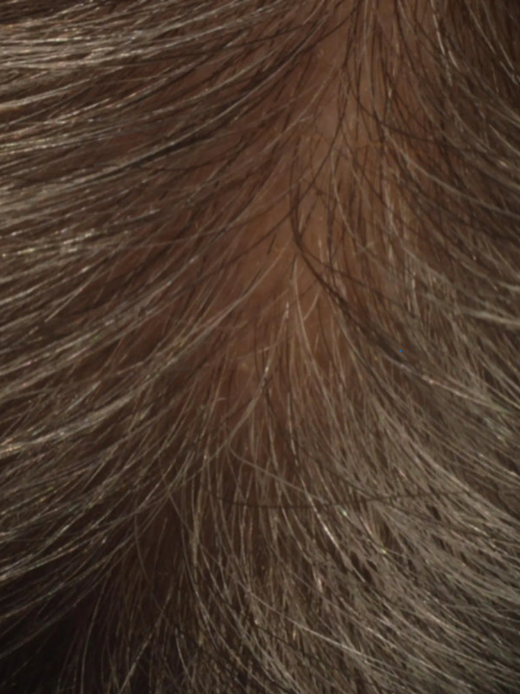 Casque LED & laser cheveux "Le Professionnel" – NOOANCE PARIS